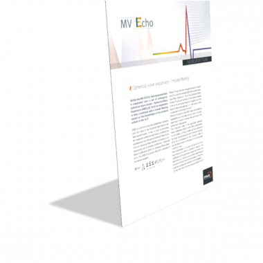 MVG : Product catalogs